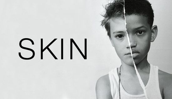 Skin (2018) | Where to Stream & Watch Online?